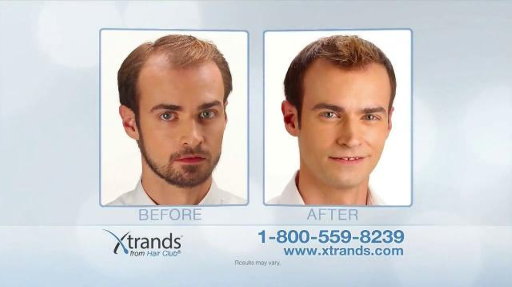 Hair Club Xtrands TV Commercial, 'A Revolutionary Way to New Hair ...