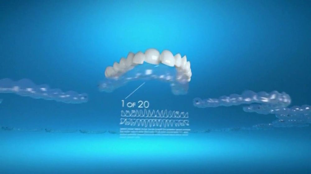 Invisalign TV Commercial, 'Gradually Straighten Your Teeth' - iSpot.tv