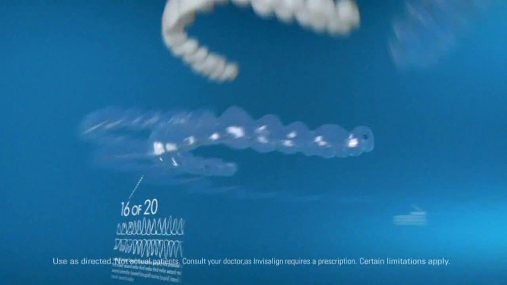 Invisalign TV Commercial, 'Gradually Straighten Your Teeth' - iSpot.tv